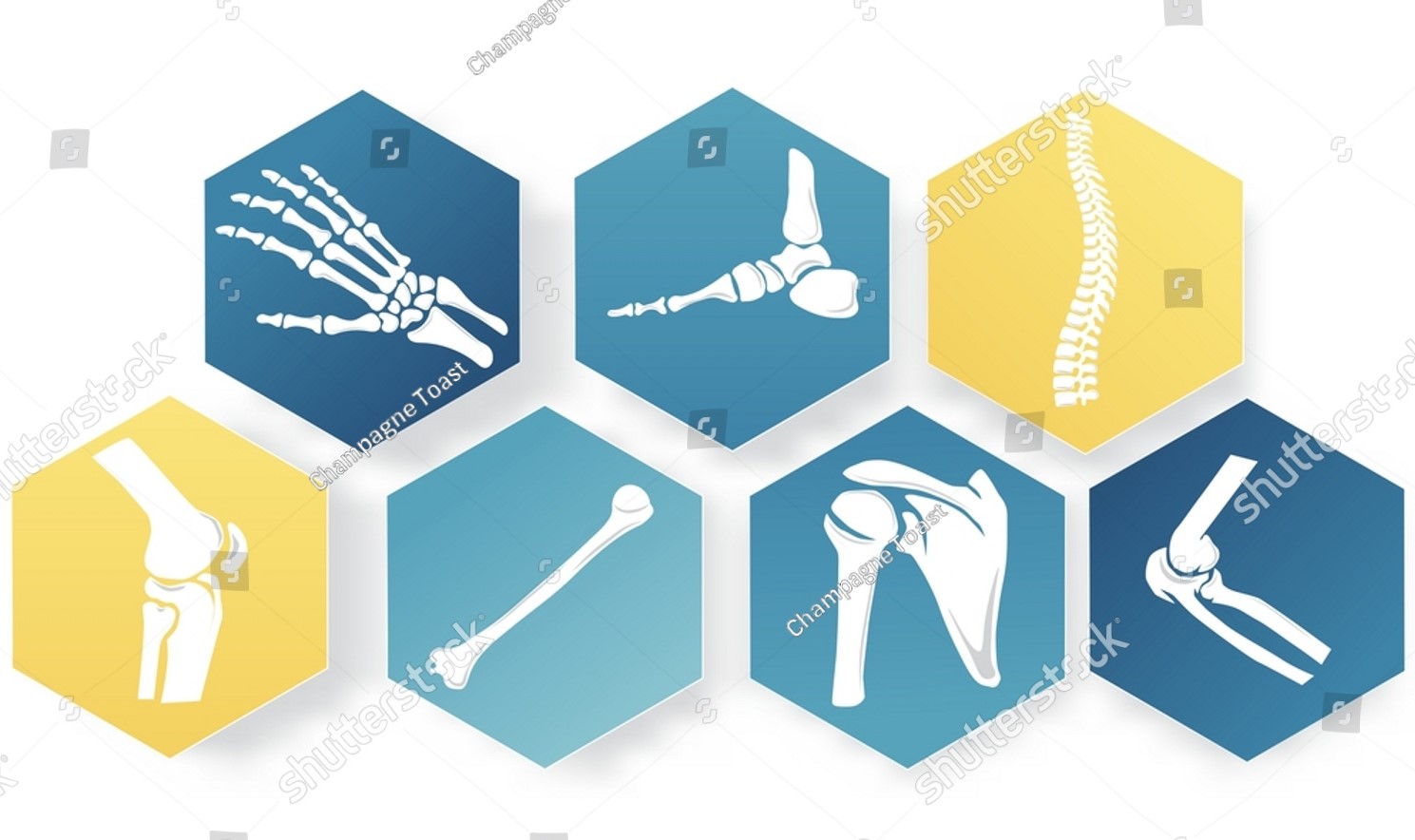 Qu'est-ce que la chirurgie orthopédique et traumatologique